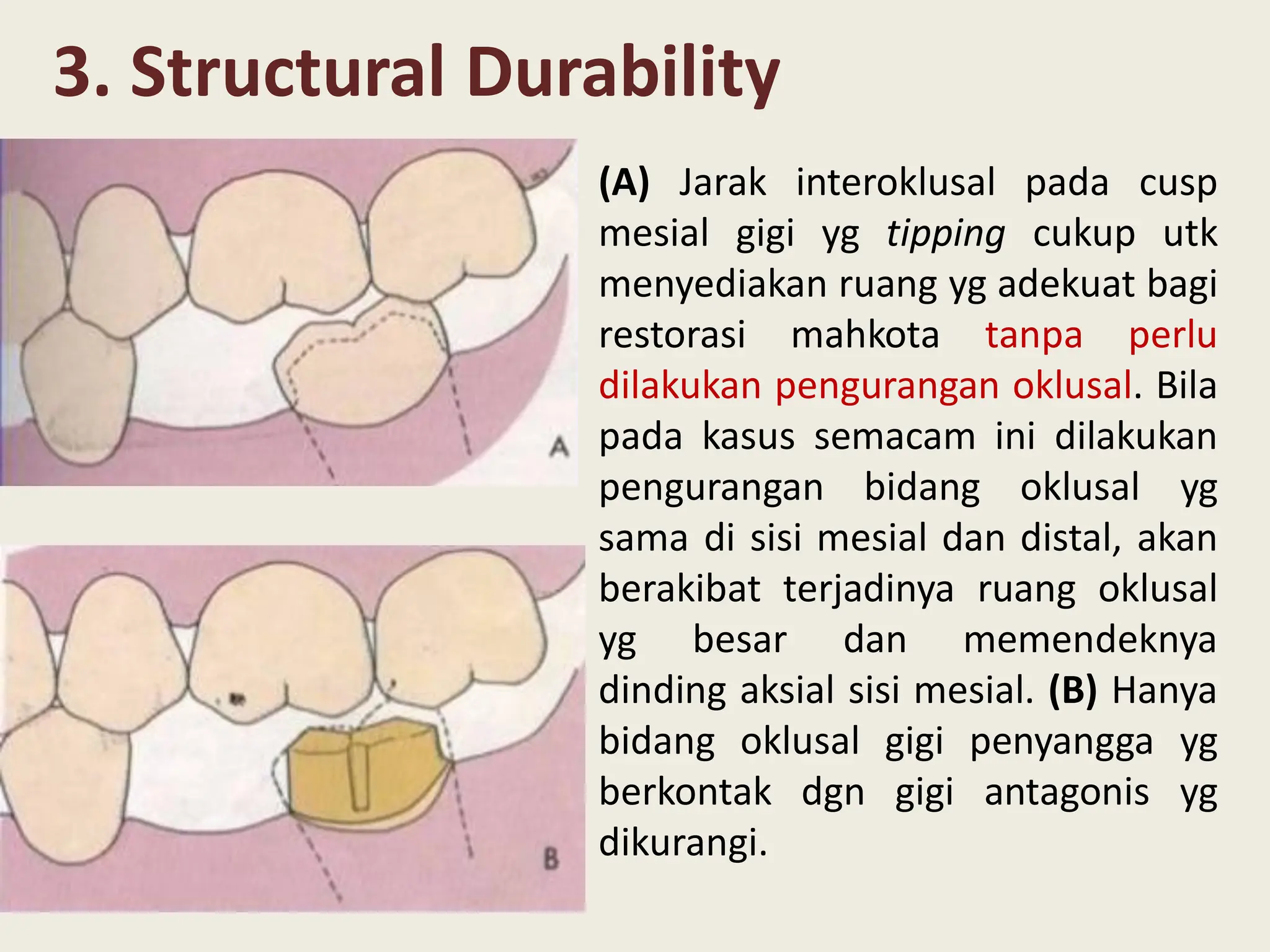 prinsip preparasi dalam pembuatan gigi tiruan jembatan | PDF