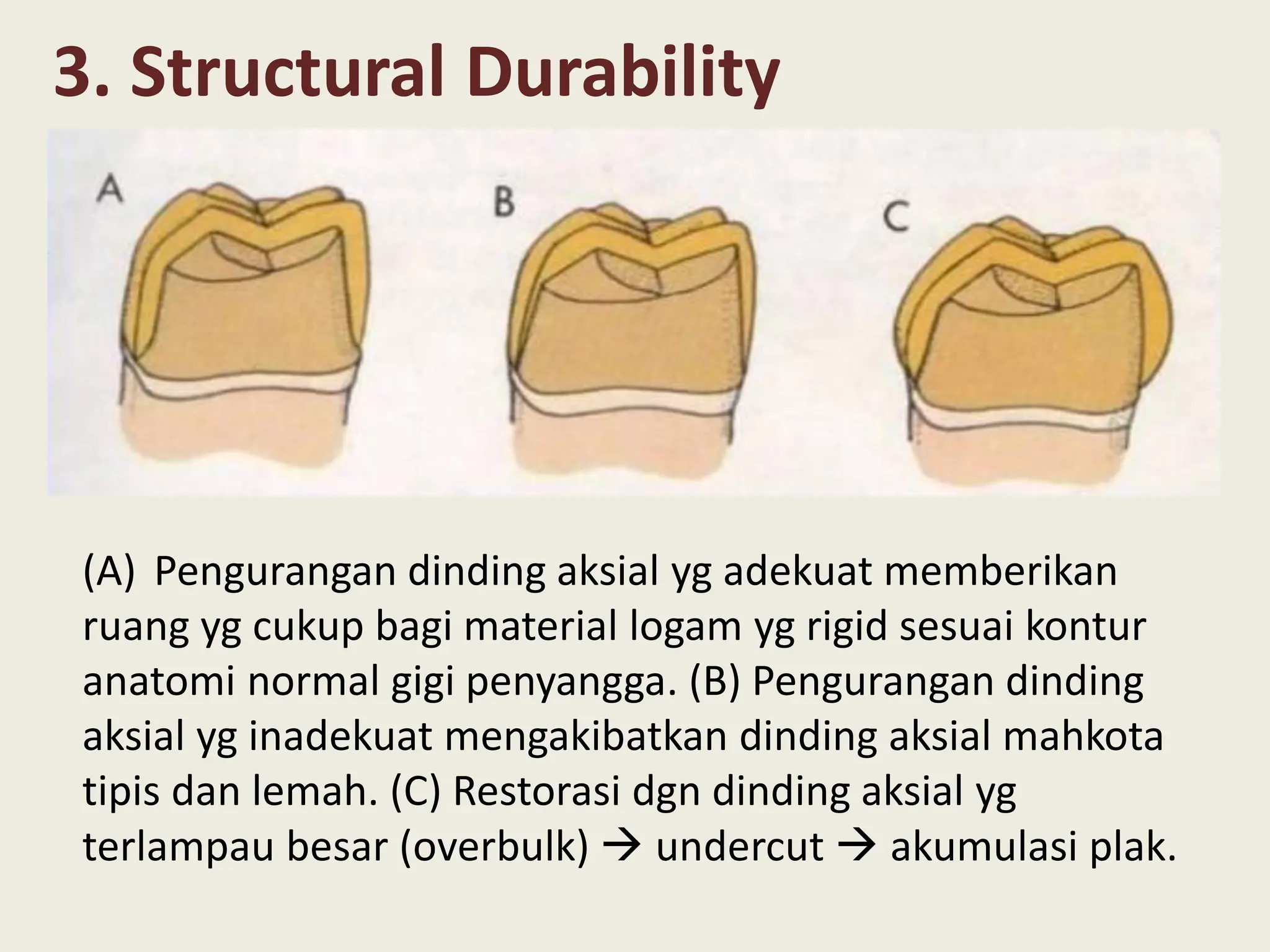 prinsip preparasi dalam pembuatan gigi tiruan jembatan | PDF