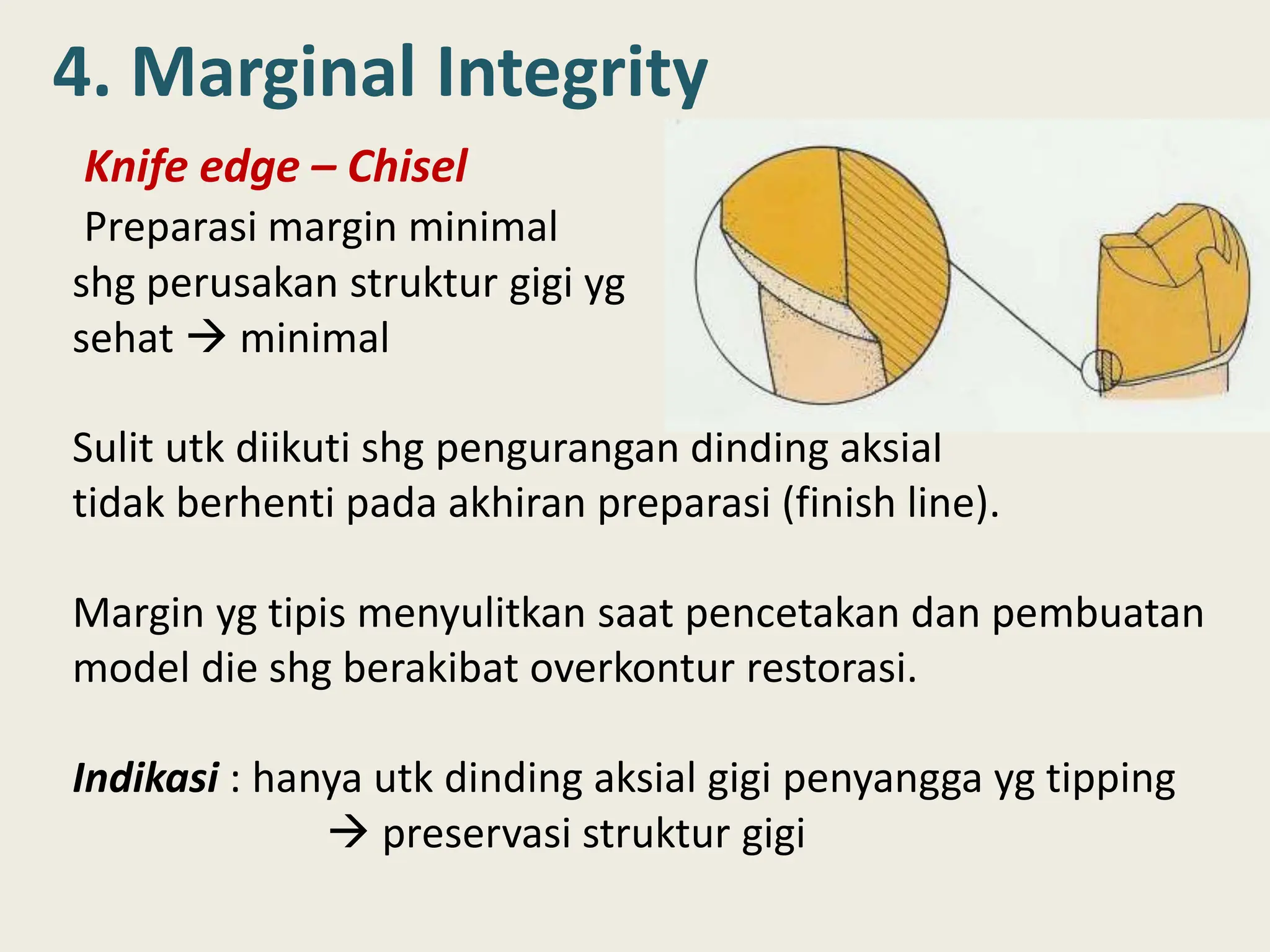 prinsip preparasi dalam pembuatan gigi tiruan jembatan | PDF
