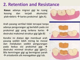 prinsip preparasi dalam pembuatan gigi tiruan jembatan | PDF