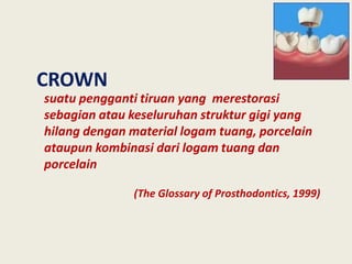 prinsip preparasi dalam pembuatan gigi tiruan jembatan | PDF