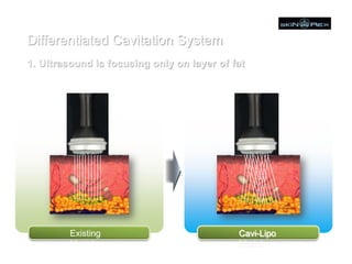 2011 cavi lipo-presentetion | PPT