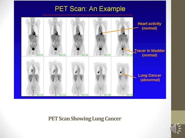 Positron Emission Tomography | PPTX