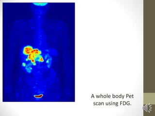 Positron Emission Tomography | PPTX