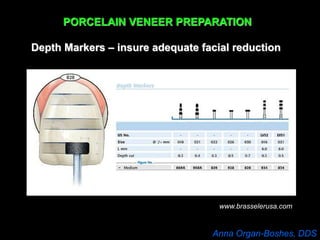 Veneer Preparation and Provisional | PPT