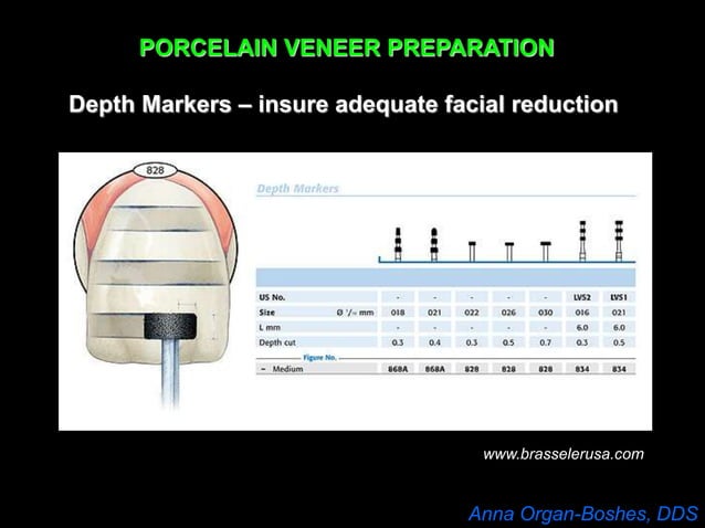 Veneer Preparation and Provisional | PPT