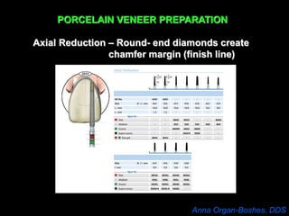 Veneer Preparation and Provisional | PPT