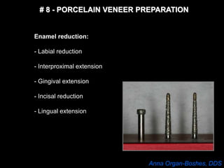 Veneer Preparation and Provisional | PPT
