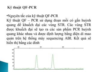 Nghiên cứu ứng dụng kỹ thuật QF-PCR Trong Chẩn Đoán Trước Sinh Các Hội ...