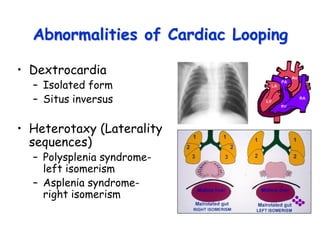 Human Cardiac embryology - 전이경 교수 | PDF | Heart and Cardiovascular ...