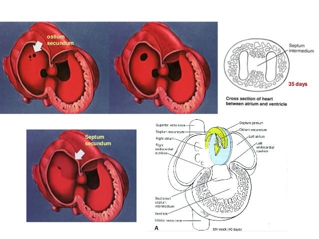 Human Cardiac embryology - 전이경 교수