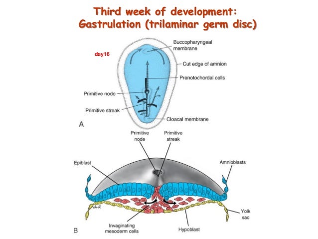 Trilaminar Disc