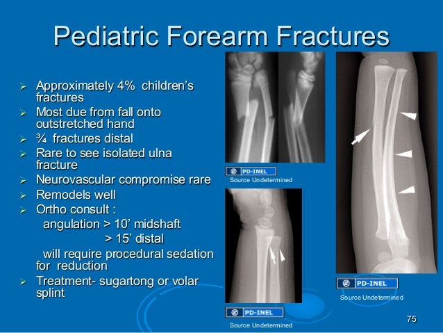 GEMC: Pediatric Orthopedic Emergencies: Resident Training
