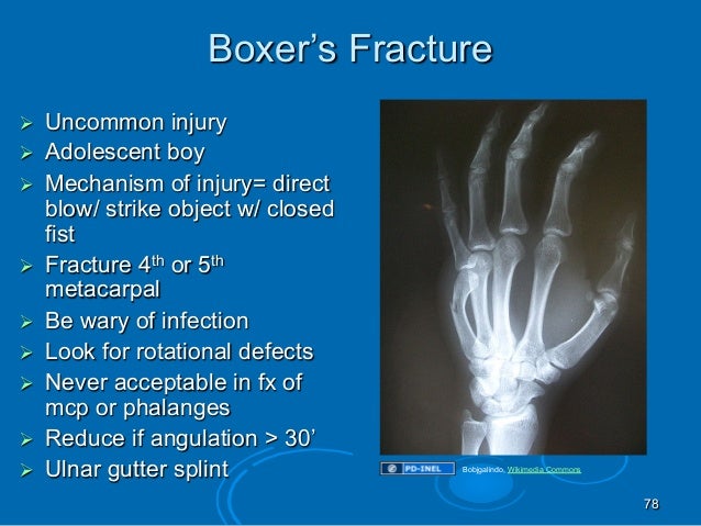 GEMC: Pediatric Orthopedic Emergencies: Resident Training