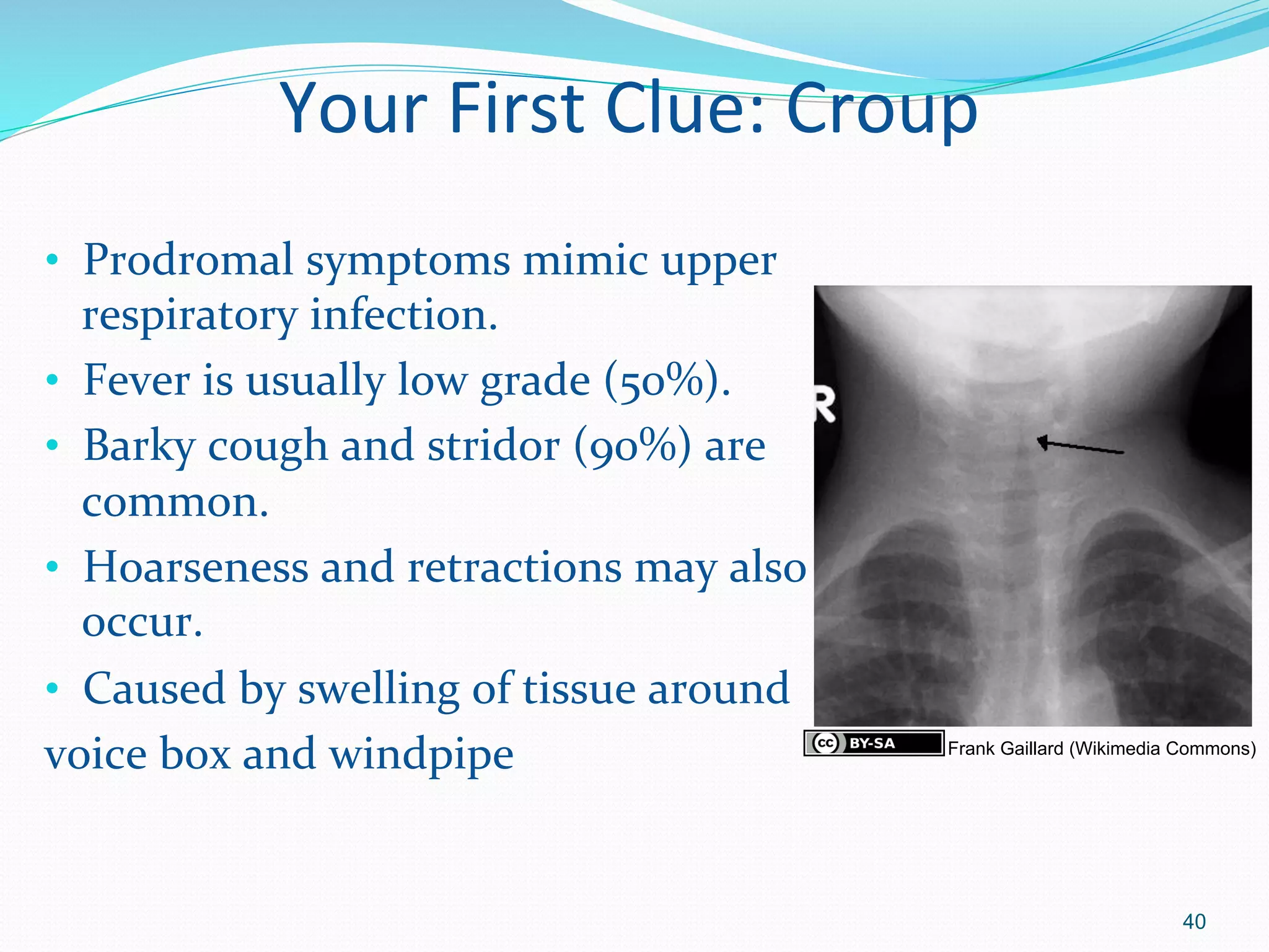 GEMC: Pediatric Respiratory Distress: Resident Training | PDF