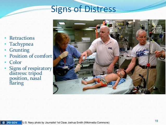 Tripod Position Respiratory Distress