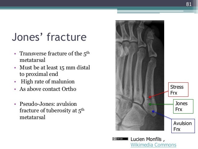 GEMC- Injuries of the Lower Extremity: Knee, Ankle and Foot- Resident…