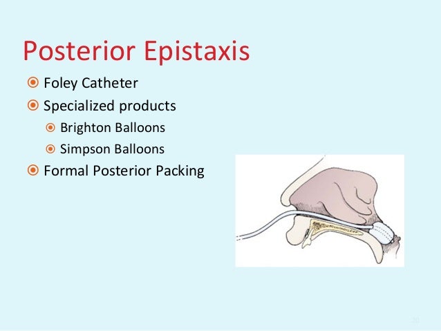 GEMC: Evaluation and Management of Epistaxis: Resident Training