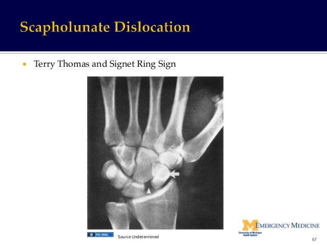 GEMC: Upper Extremity Injuries: Shoulder, Elbow and Wrist: Resident T…