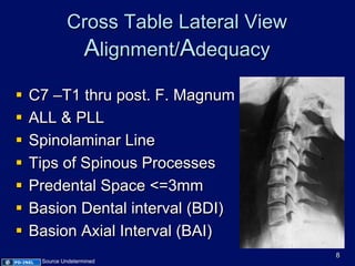 GEMC: The Role of Radiography in the Initial Evaluation of C-Spine ...