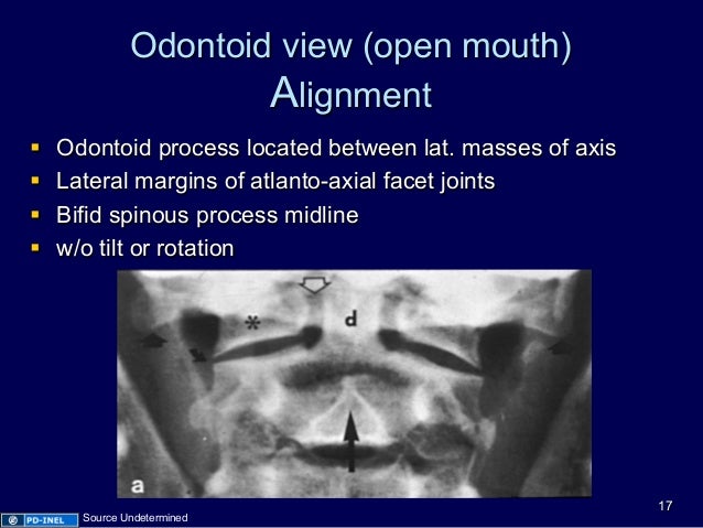 GEMC: The Role of Radiography in the Initial Evaluation of C-Spine Tr…