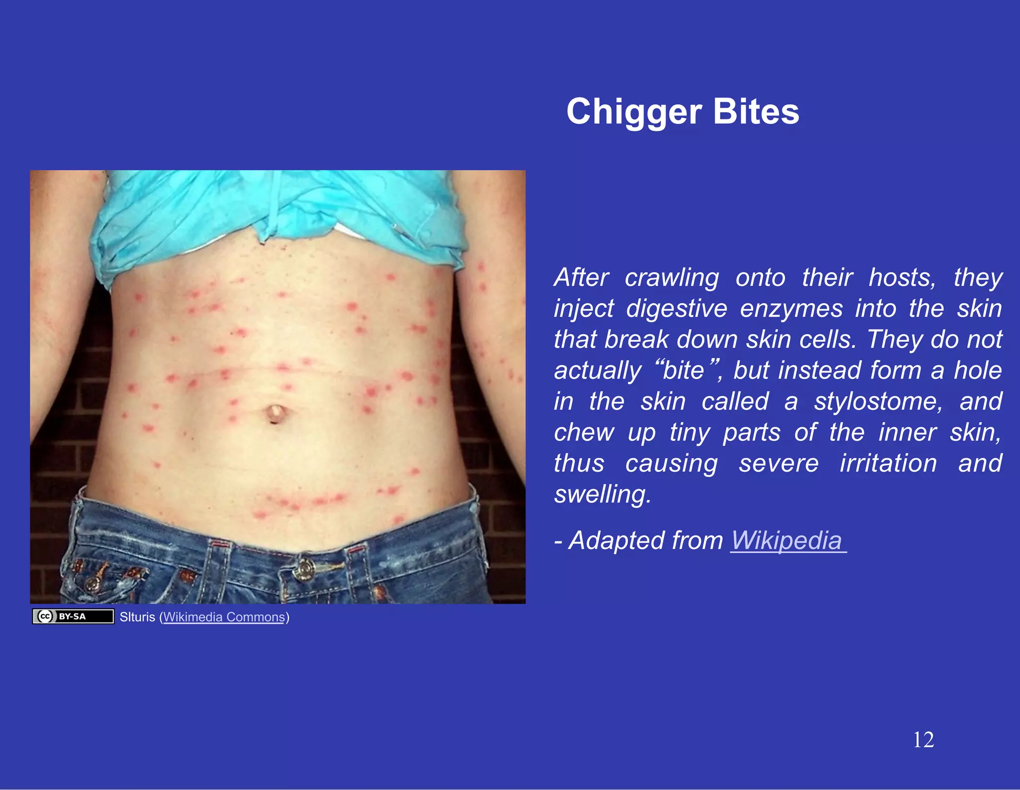 GEMC - Insect stings spider bites-Resident Lectures | PDF