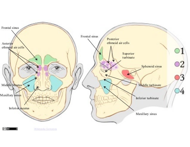 GEMC - Sinusitis - Resident Training