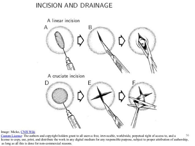 GEMC- Skin Emergencies- for Residents