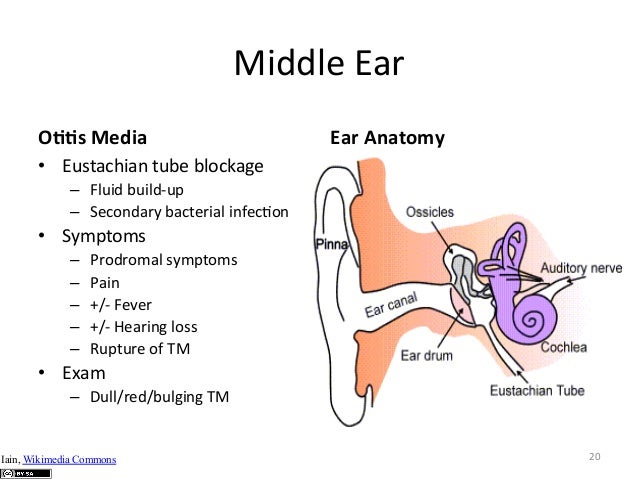 Barotrauma ear from a blast - ukraineent