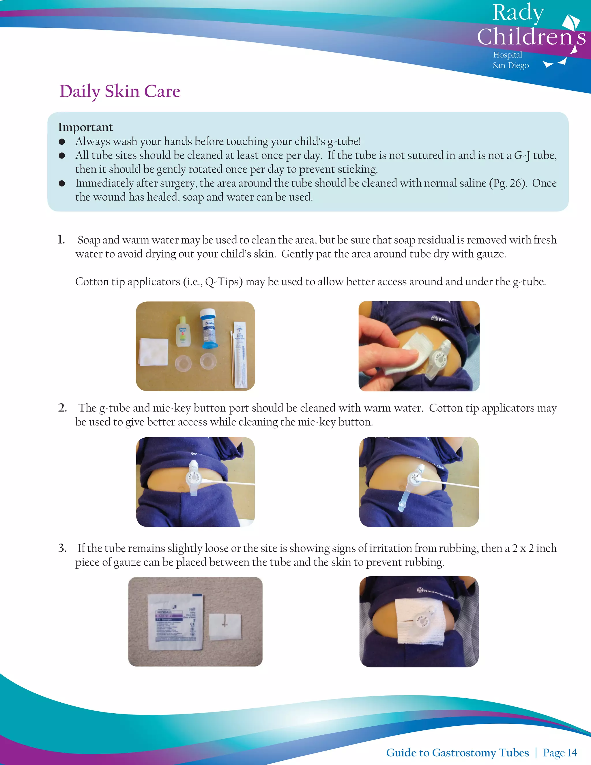 Guide to Gastrostomy Tubes | PDF