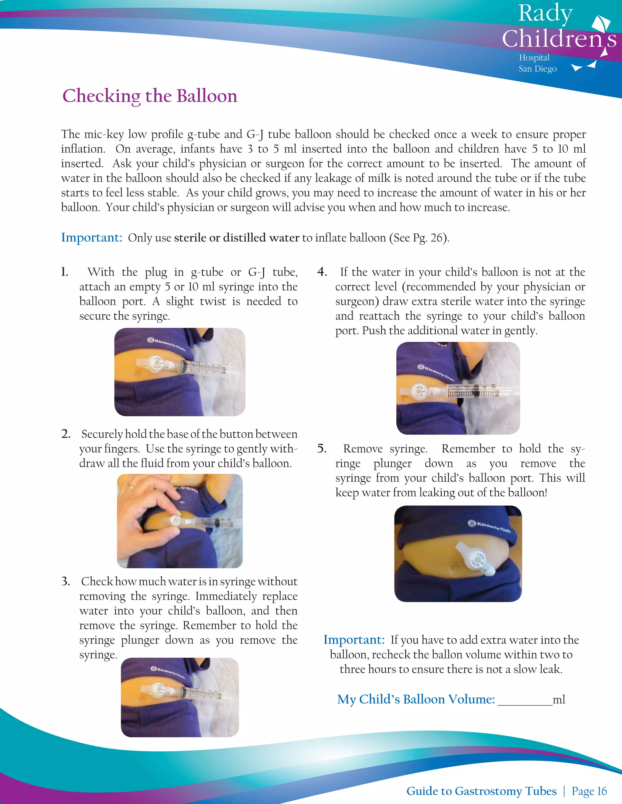 Guide to Gastrostomy Tubes | PDF