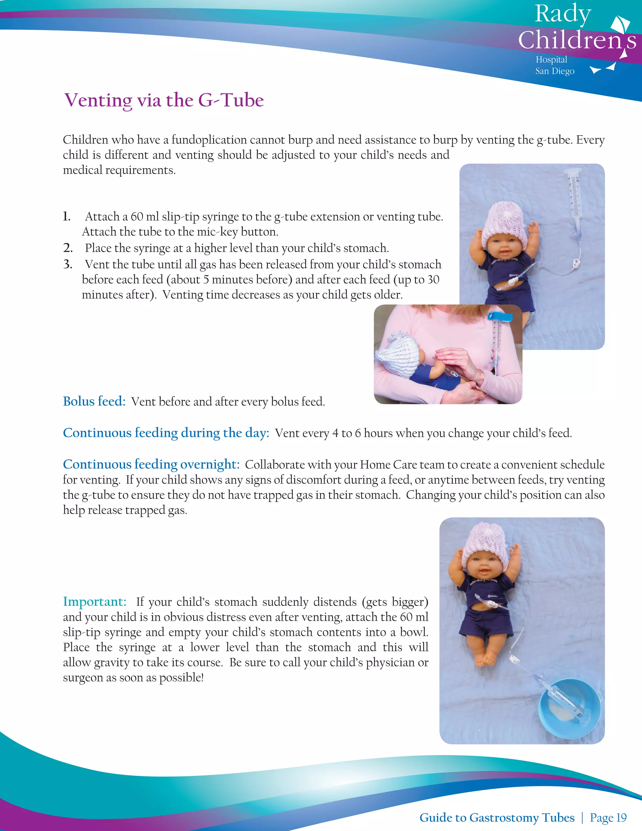 Guide to Gastrostomy Tubes | PDF