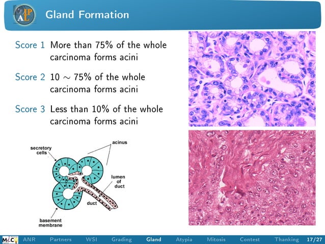 The MICO Project: COgnitive MIcroscopy For Breast Cancer Grading | PDF ...