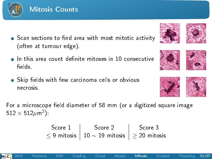 The MICO Project: COgnitive MIcroscopy For Breast Cancer Grading