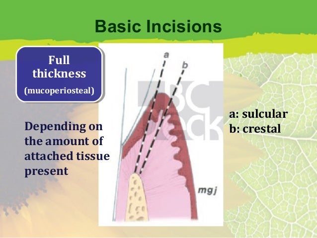Periodontal Flap Surgery