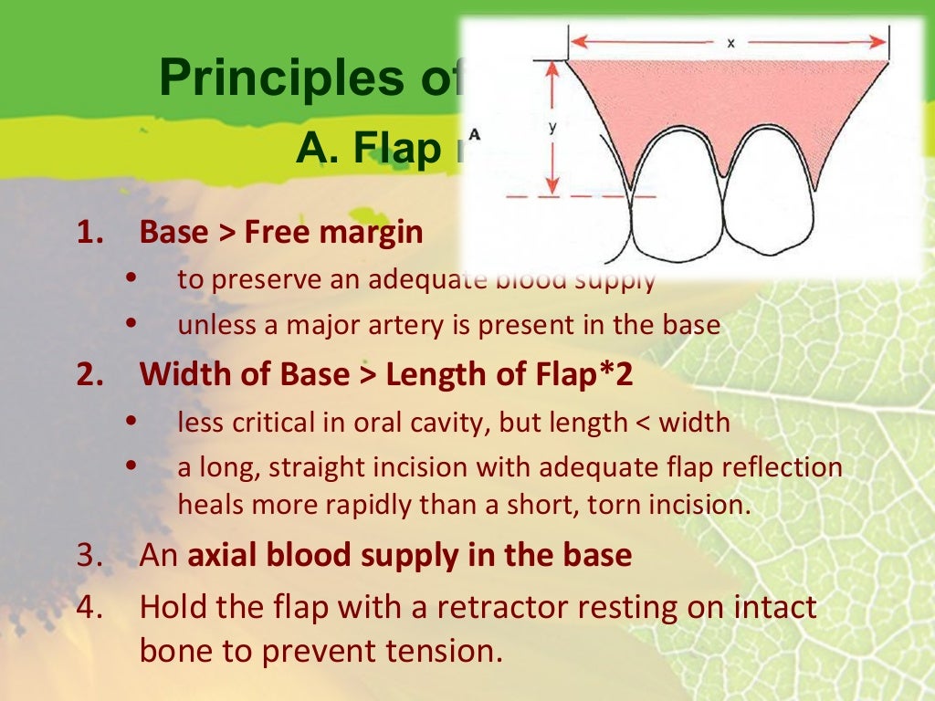 Periodontal Flap Surgery