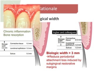Contemporary Crown-lengthening Therapy | PPT