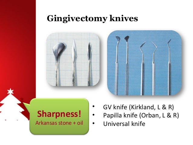 Gingivectomy