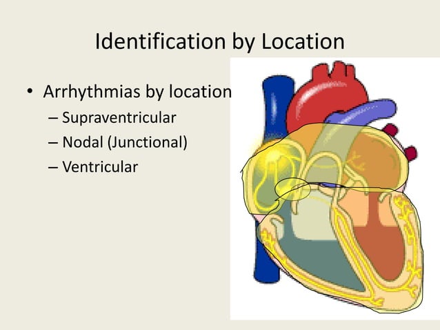 2012 cardiac lecture 2 pathologies | PPT