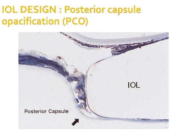 NW2012 Intraocular Lens Design and Effects on Vision