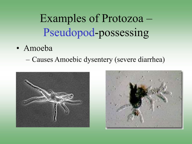 kingdom protista 2012 Protist Slides.ppt