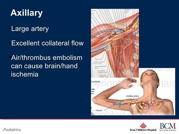 2012 vascular access pt 2