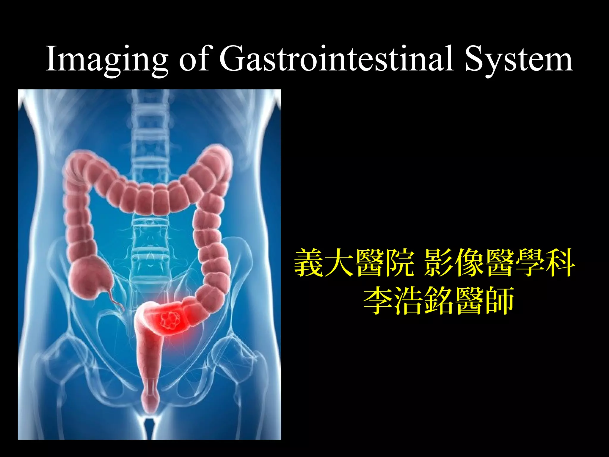 imaging of gi system | PPT