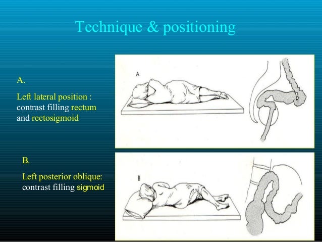 imaging of gi system