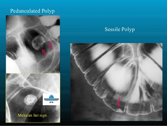 imaging of gi system