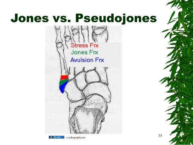 GEMC - Plain Films of the Foot and Ankle - Resident Training