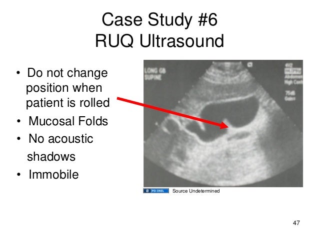 GEMC- Right Upper Quadrant Ultrasound- Resident Training
