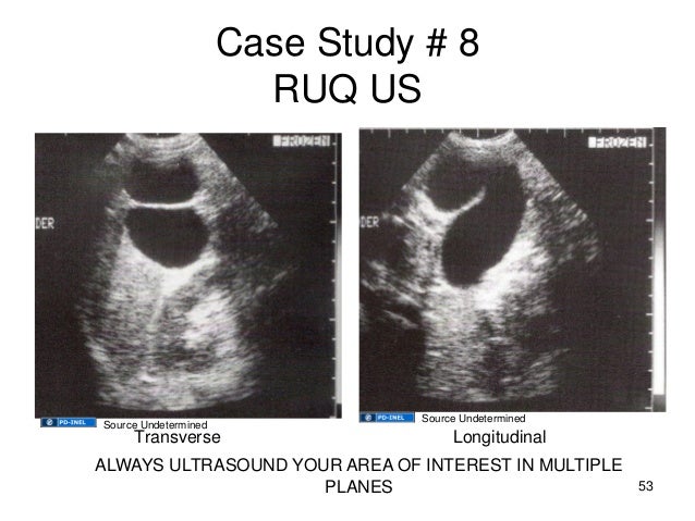 GEMC- Right Upper Quadrant Ultrasound- Resident Training