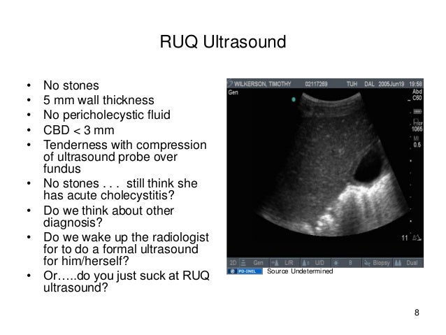 GEMC- Right Upper Quadrant Ultrasound- Resident Training