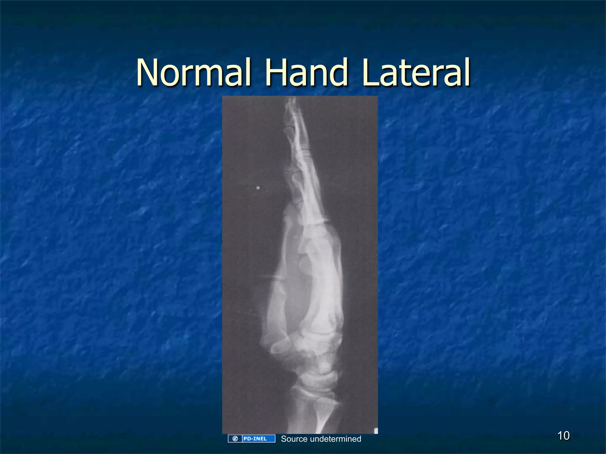 GEMC: Radiology: X-rays of the Hand and Wrist: Resident Training | PDF